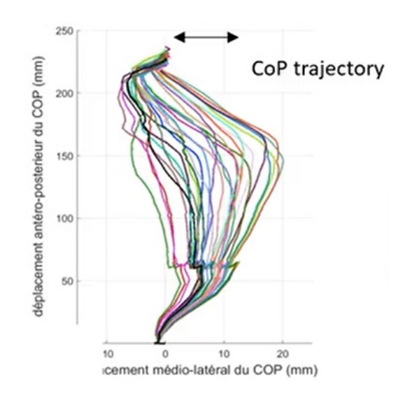 ODYSSEE幫助臨床醫學最佳化3D列印矯正鞋墊 - 星恆科技有限公司
